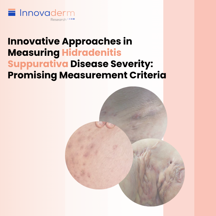 Measuring Hidradenitis Suppurativa Disease Severity