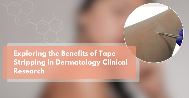 Exploring the Benefits of Tape Stripping in Dermatology Clinical ...