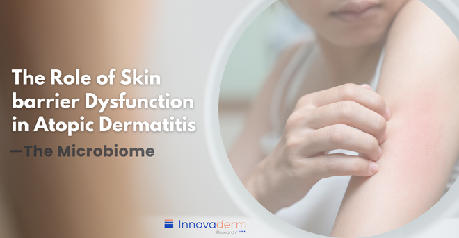 The Role of Skin barrier Dysfunction in Atopic Dermatitis—The ...